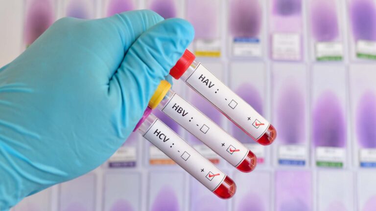 The Difference Between Hepatitis A, B, and C